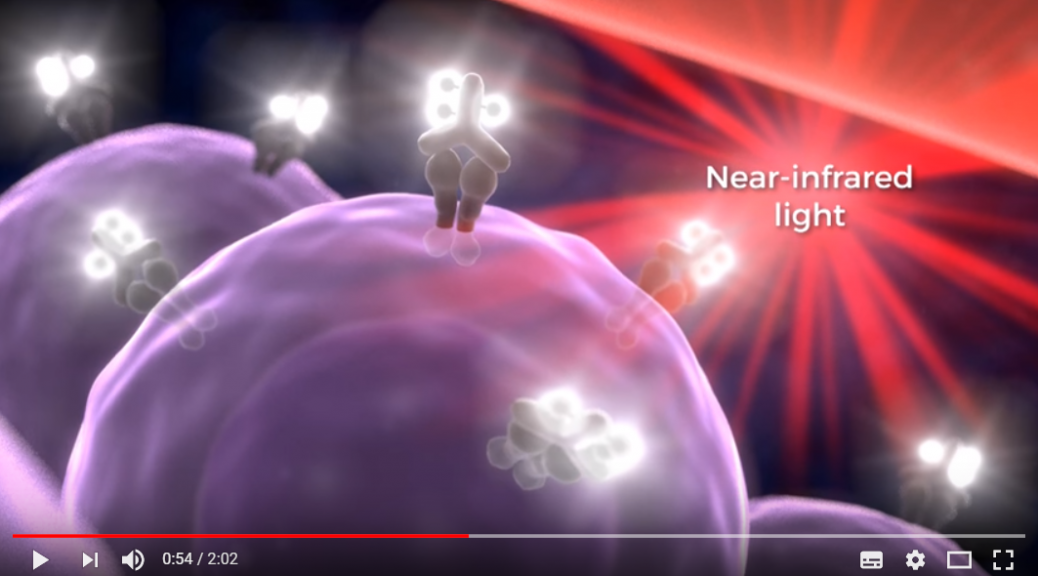 日本でも治験が始まる！#がん光免疫療法（#近赤外線光免疫療法）とは？簡単にわかりやすく！